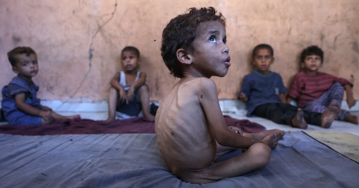 WHO chief says 'large proportion' of Gaza's people 'starving' - AL ...